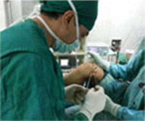 PLC Injury: Posterolateral Corner (PLC) Tear & Reconstruction | Knee ...