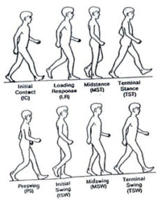 Gait | Arthroscopic Knee Surgery | Knee Specialist in Mumbai | Dr. Amyn ...