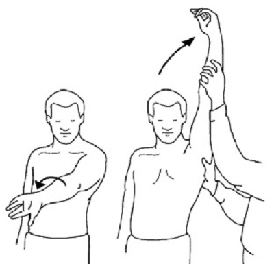 Arthroscopic Subacromial Decompression for Impingement Syndrome of the ...