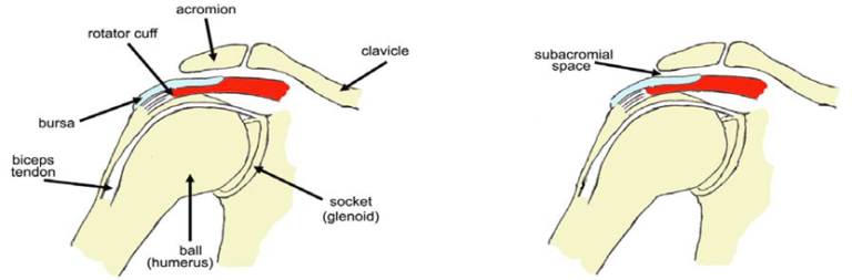 Subacromial Space | Shoulder Anatomy | Orthopaedic Surgery Specialist ...