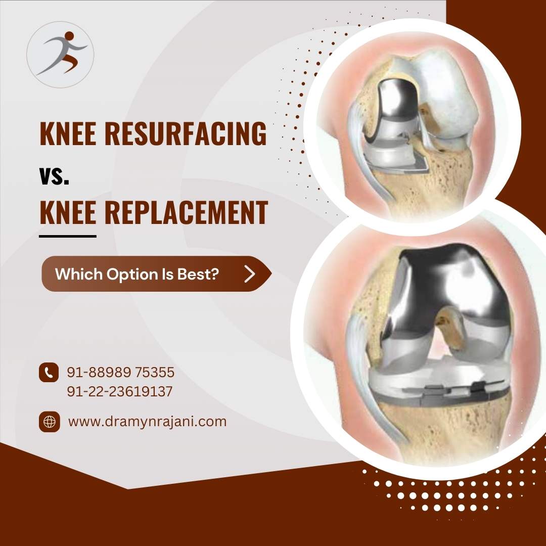 Knee Resurfacing vs. Knee Replacement – Which Option Is Best?