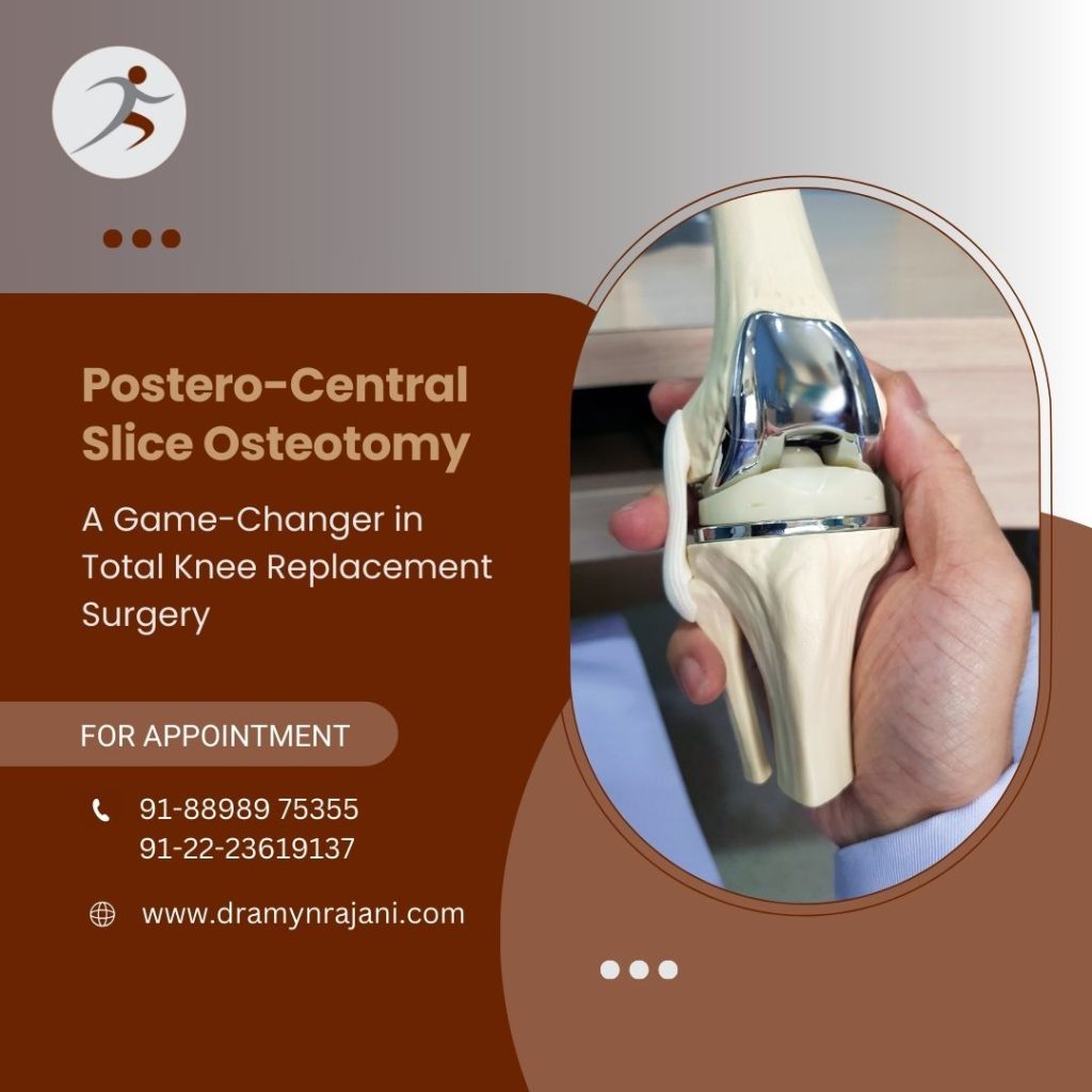 Knee Resurfacing vs. Knee Replacement – Which Option Is Best?